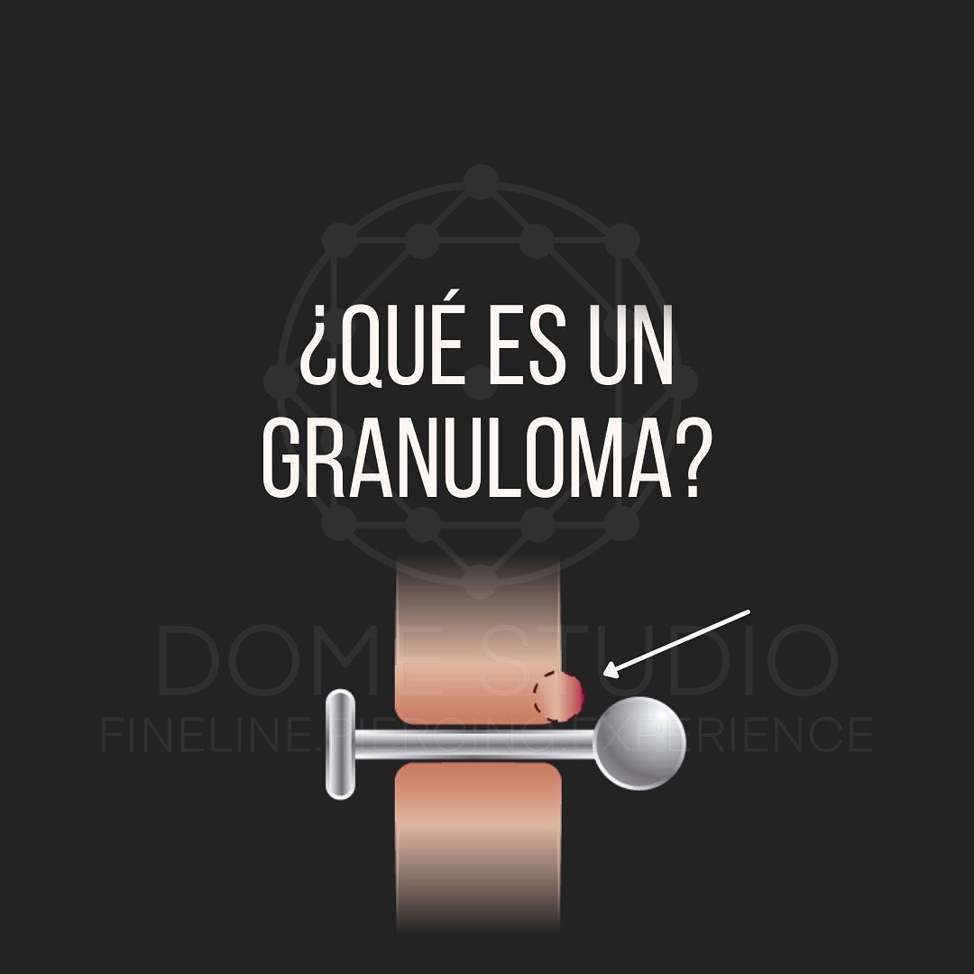 granulomas bultos en tu piercing